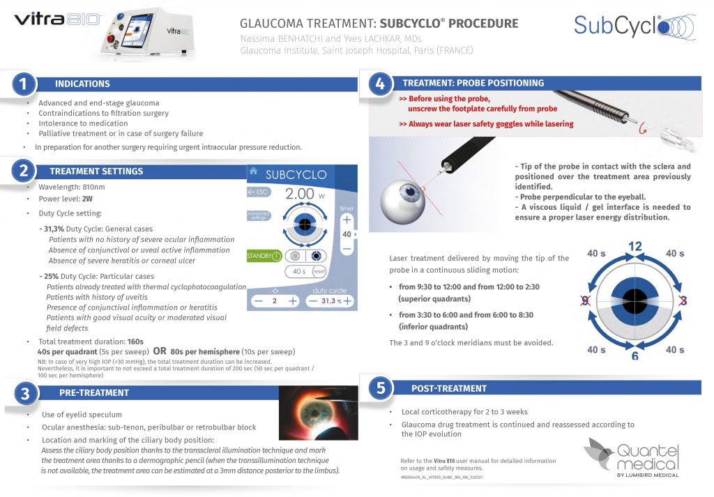 Glaucoma Treatment: SubCyclo Procedure - Glass