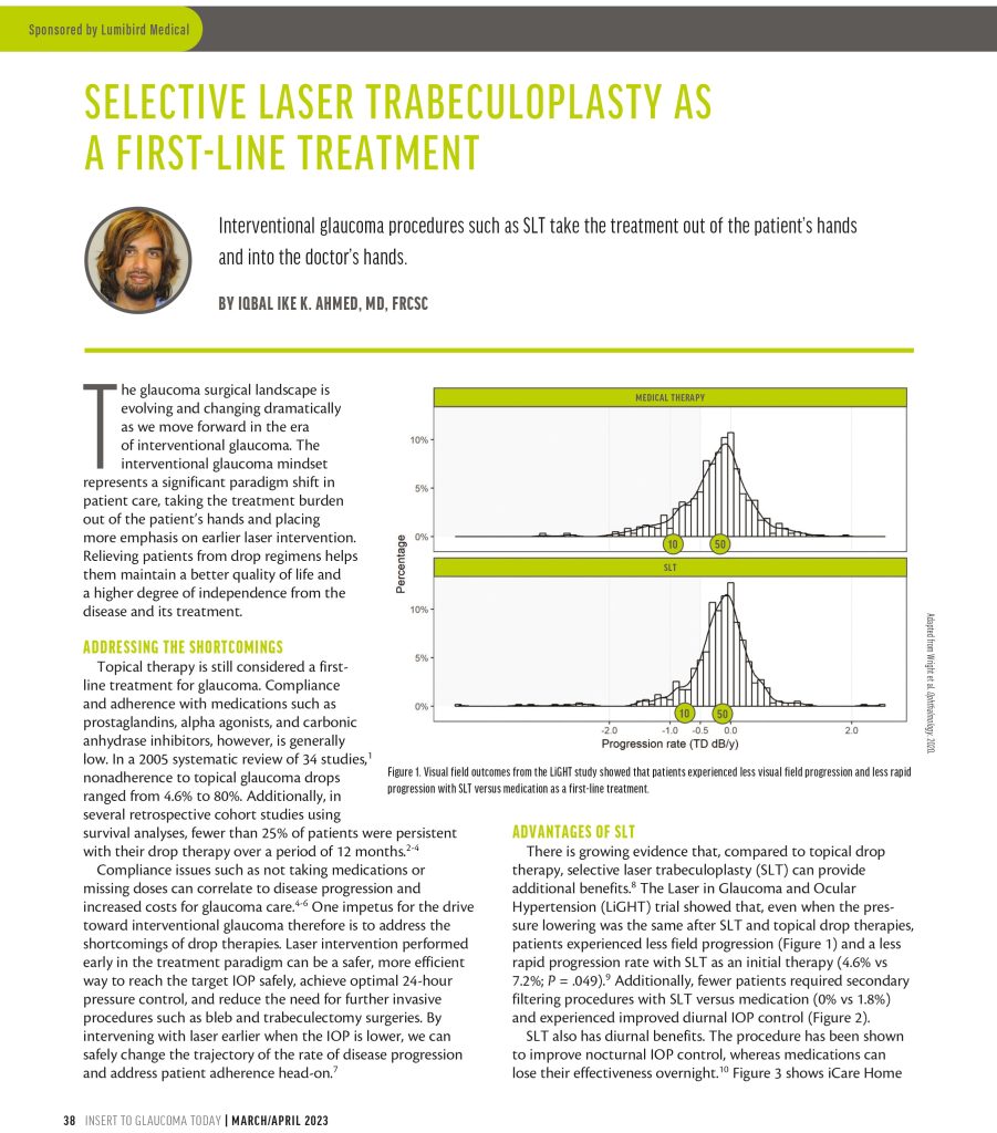 Selective Laser Trabeculoplasty as a First-line Treatment - Glass